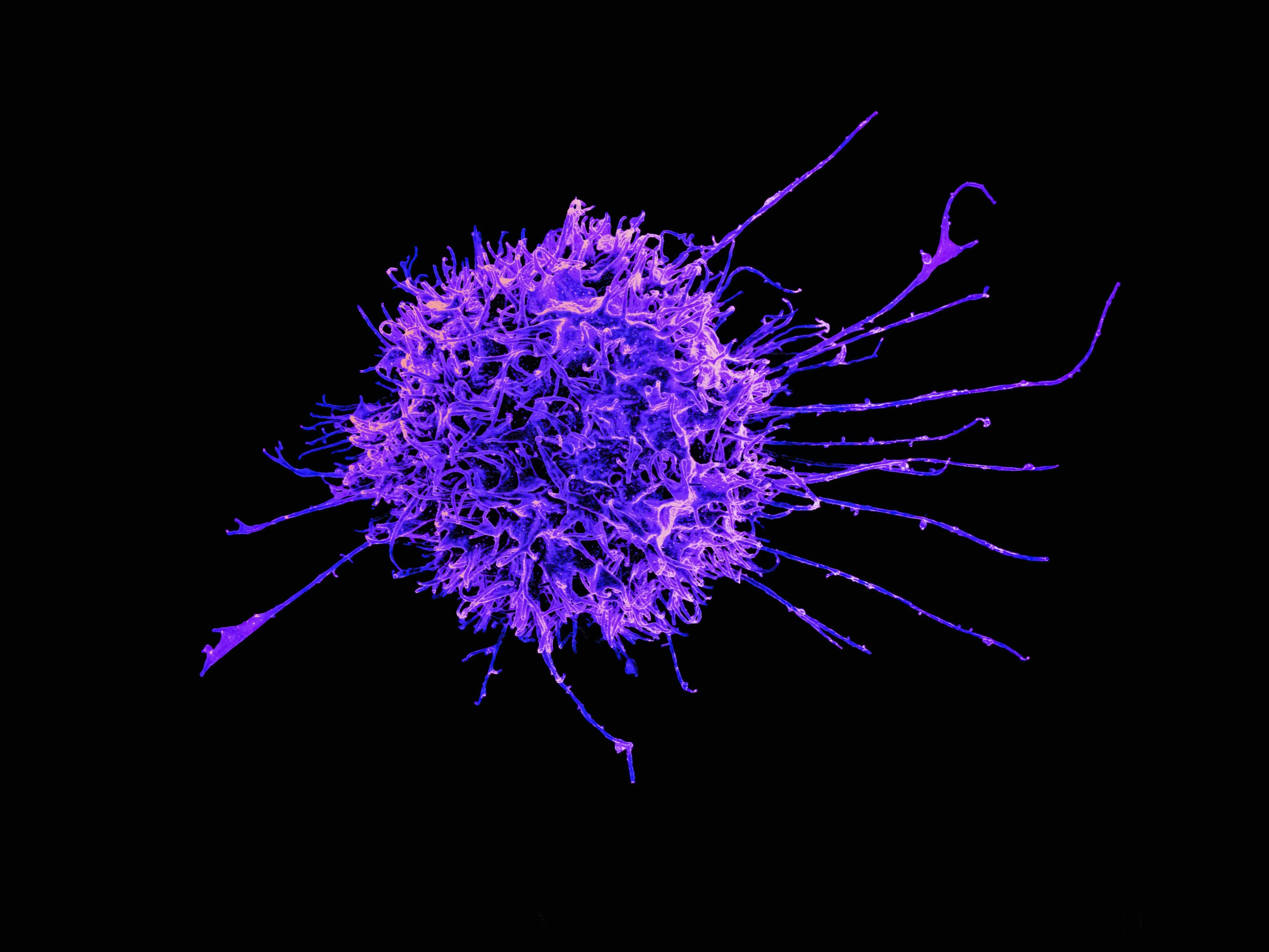 How the Immune System Fights Diseases: Antibodies, Vaccines & Lasting ...