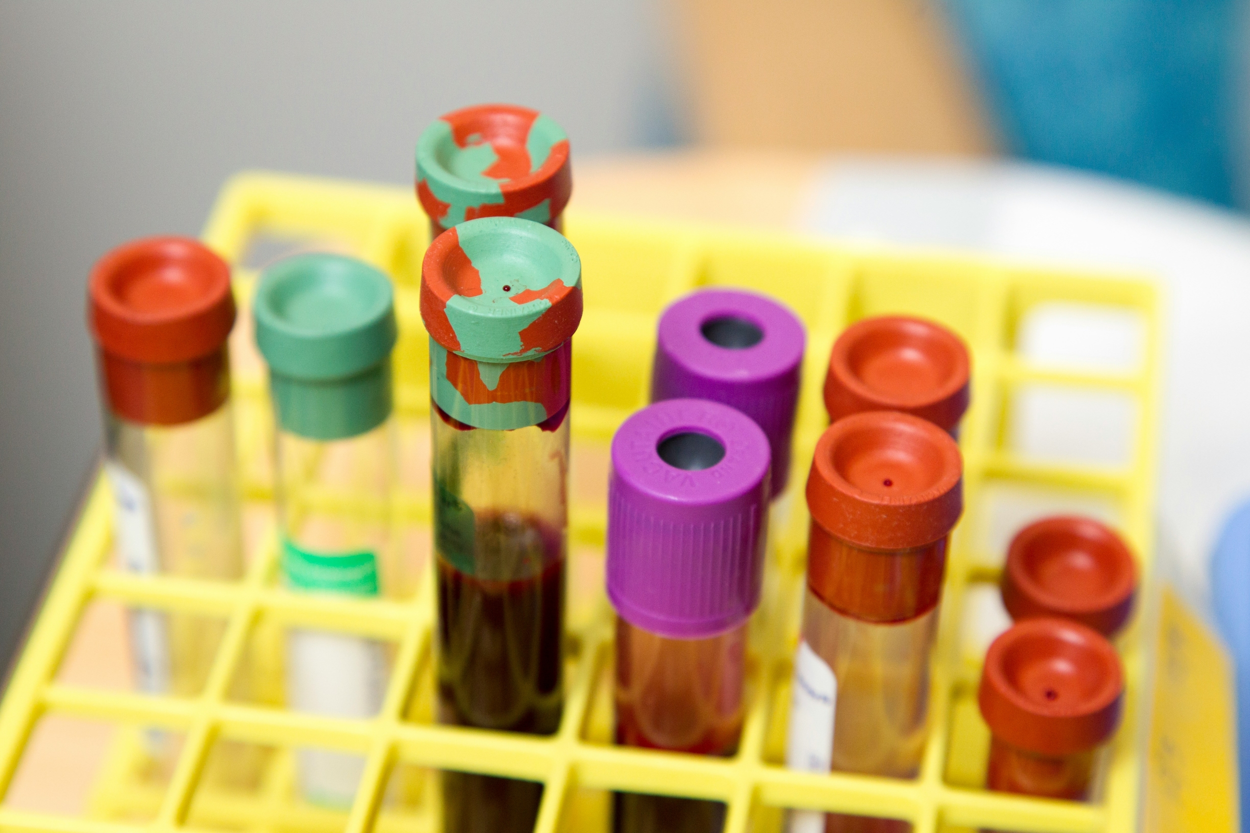 Why Are There Different Blood Types? Understanding The Science Behind ...