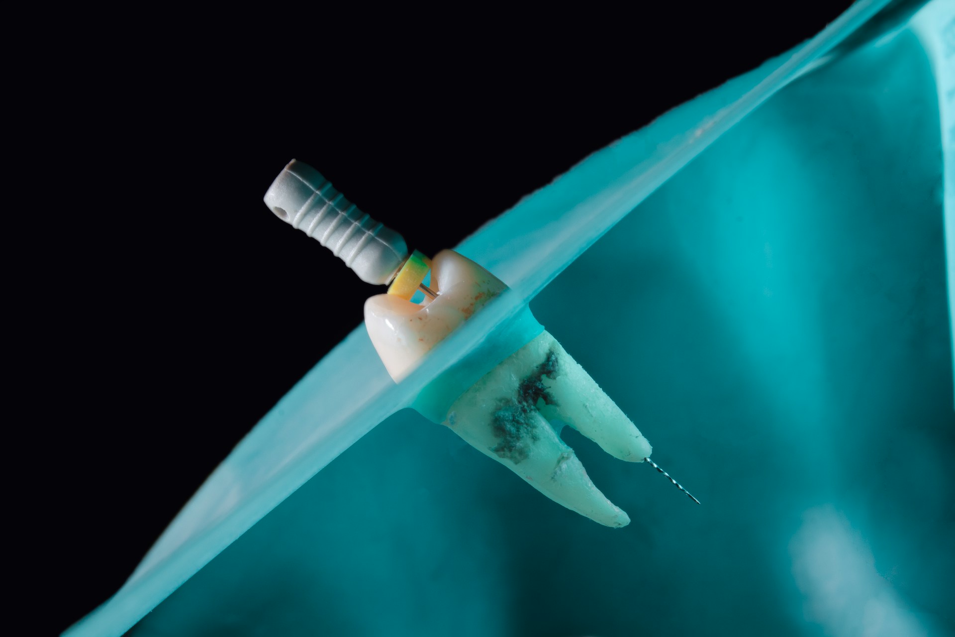 AI-Powered Full Arch Implant Systems 2026: Full Mouth Dental Implant ...